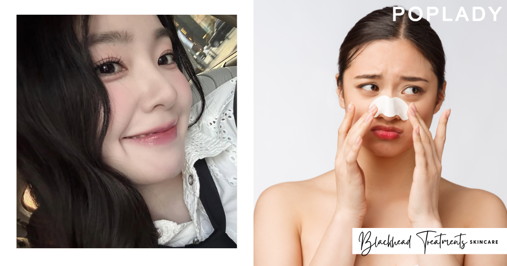 去黑頭粉刺推薦2025｜9款溫和產品！告別草莓鼻 破解黑頭貼迷思