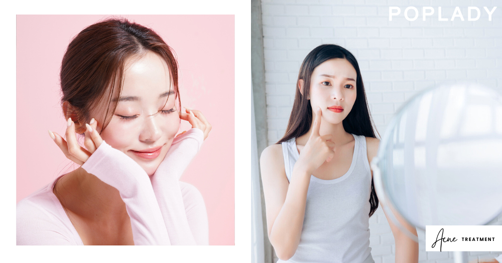 去暗瘡攻略｜種類+4招急救法+72小時快速去暗瘡印+日常預防貼士